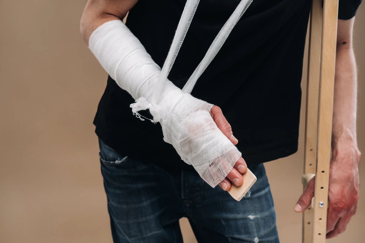 Broken Bones from a Queens Auto Accident | Cohen & Cohen